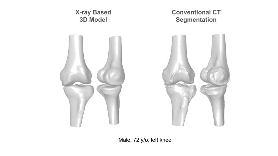 XPlan.ai Confirms Premier Precision In Peer-Reviewed Clinical Study Of ... XPlan.ai Confirms Premier Precision In Peer-Reviewed Clinical Study Of ...
